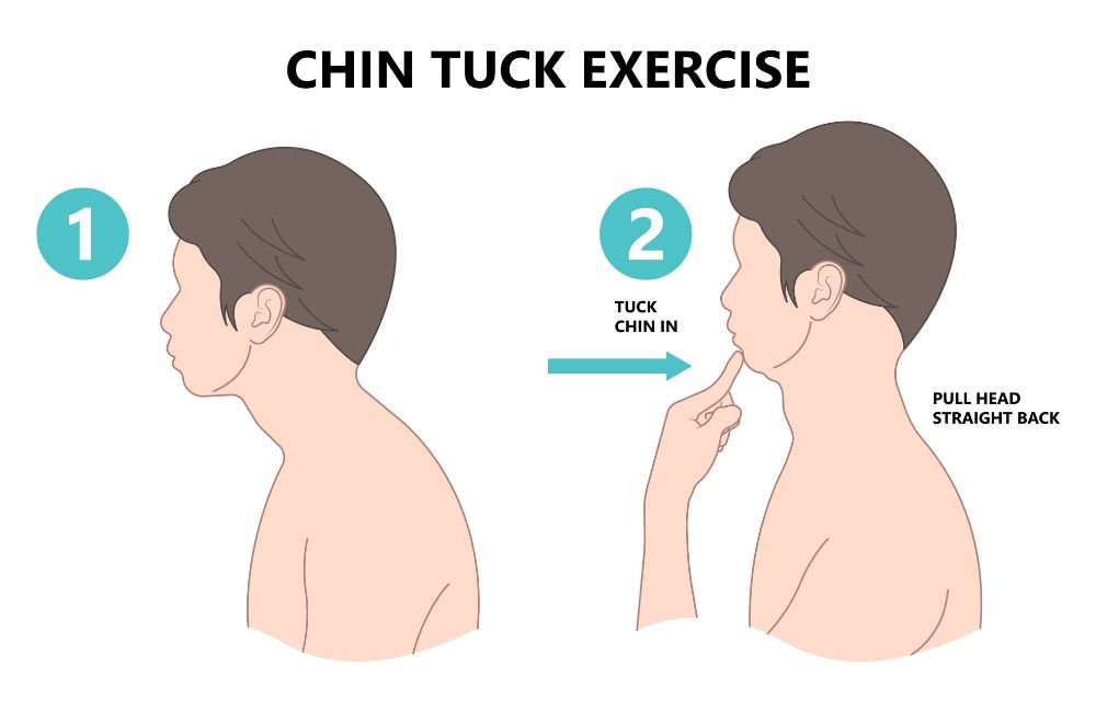 5 Easy Chin Tuck Exercises Improve Your Head Posture Fast 5 Easy Chin Tuck Exercises Improve Your Head Posture Fast